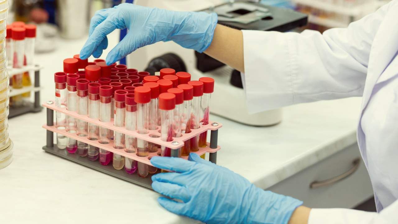 Exames Laboratoriais: quais são os principais e qual sua importância